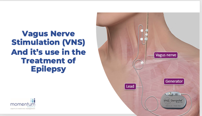 Vagus Nerve Stimulation Training - Momentum People